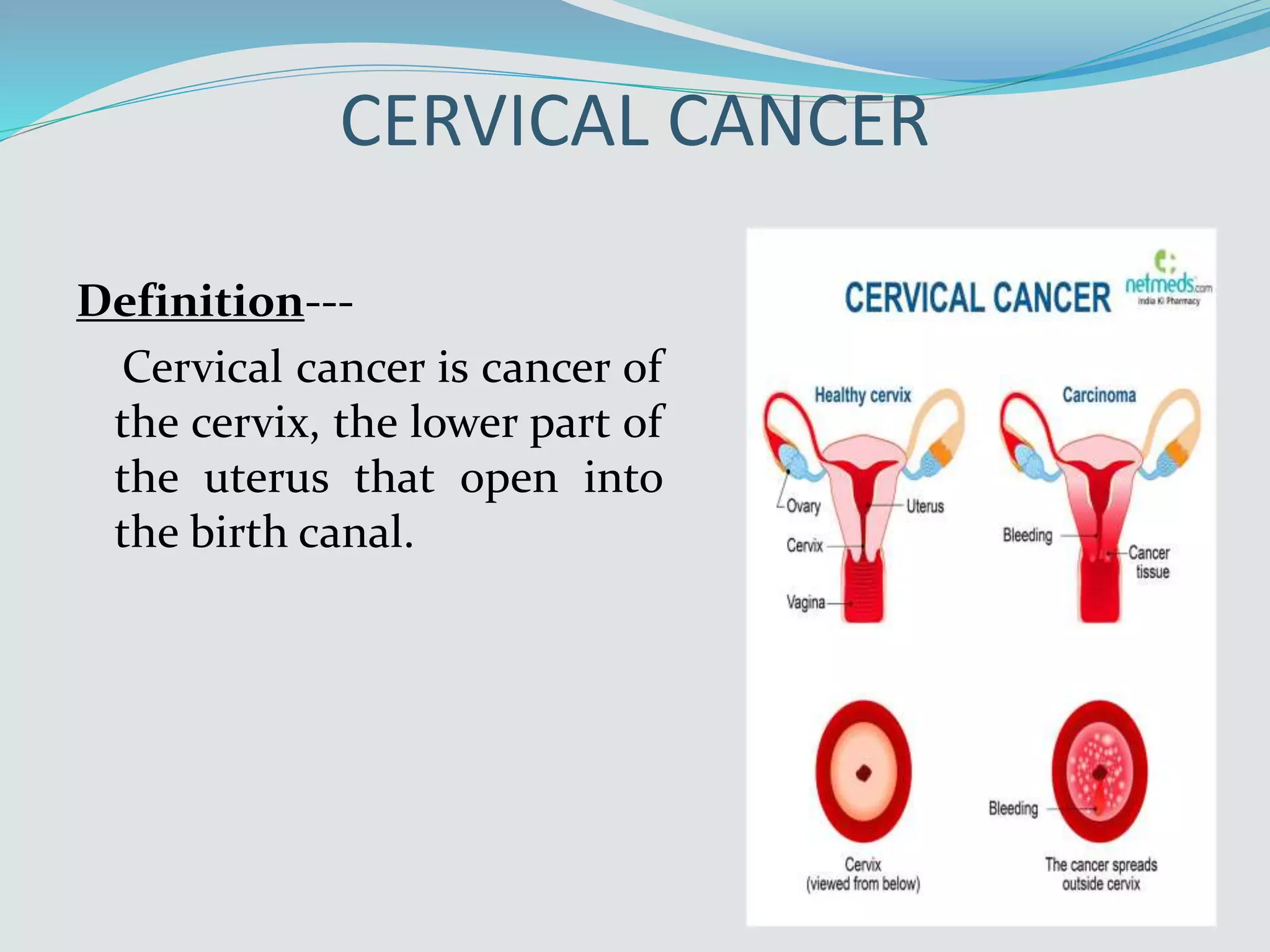 Cervical cancer | PPTX