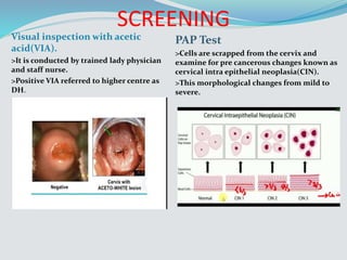 Cervical cancer | PPTX