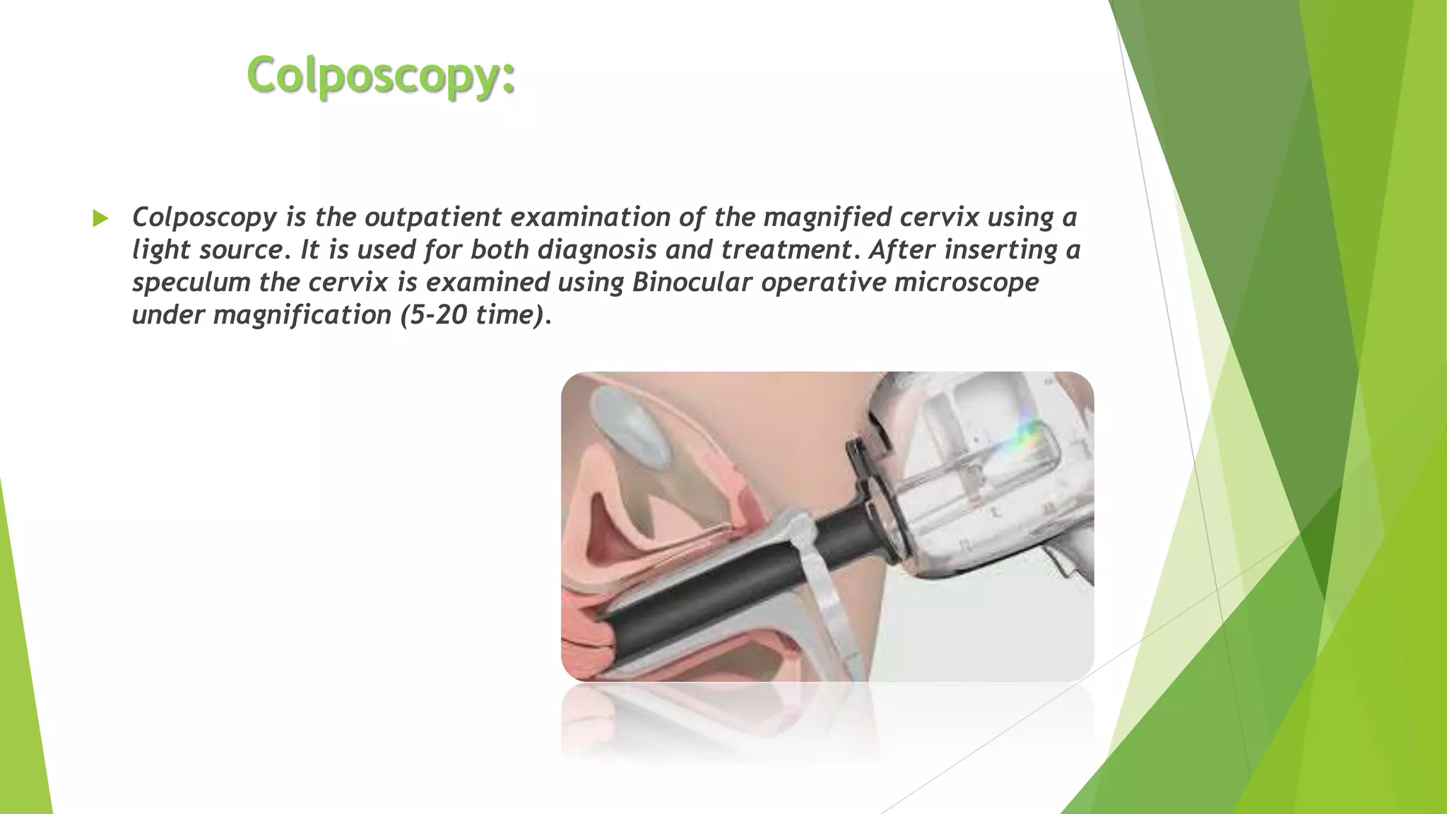 Cervical cancer | PPTX