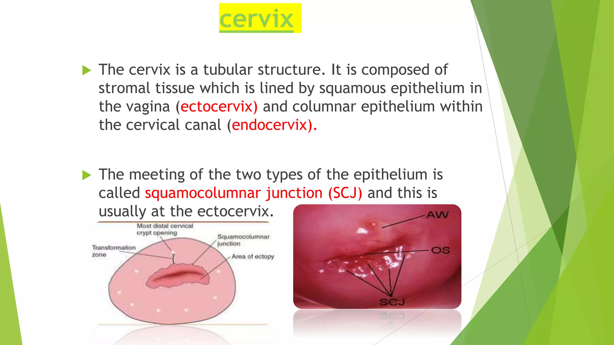 Cervical cancer | PPTX