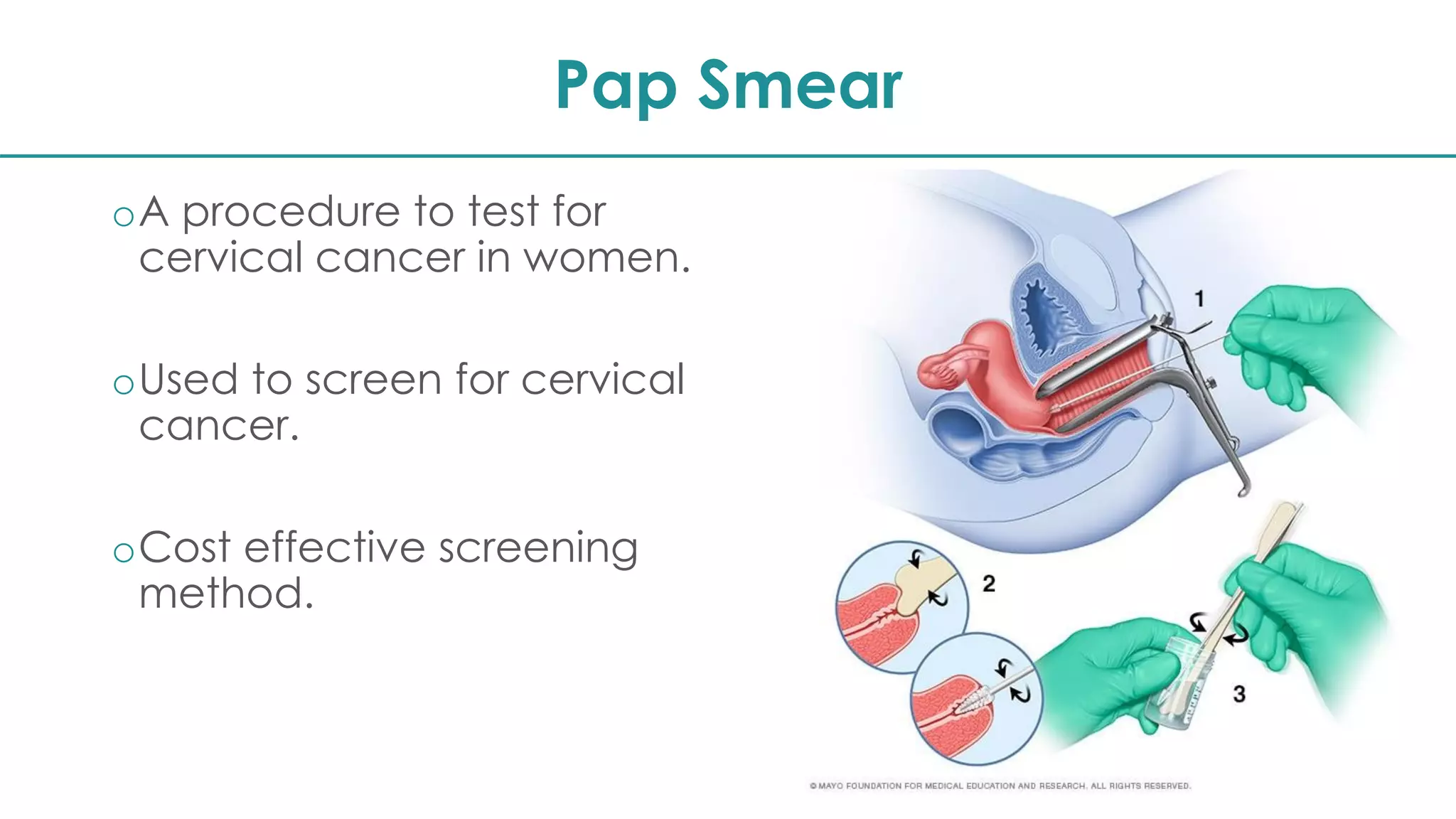 CERVICAL CANCER | PDF