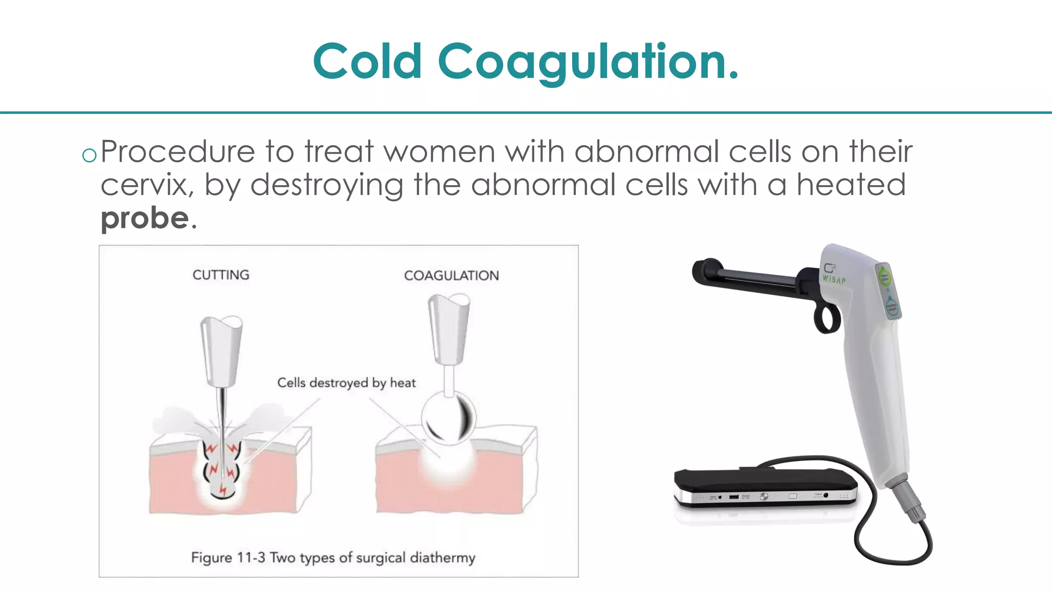 CERVICAL CANCER | PDF