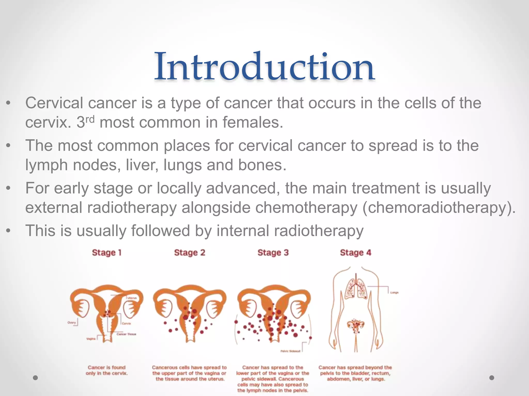 Cervical Cancer | PPT