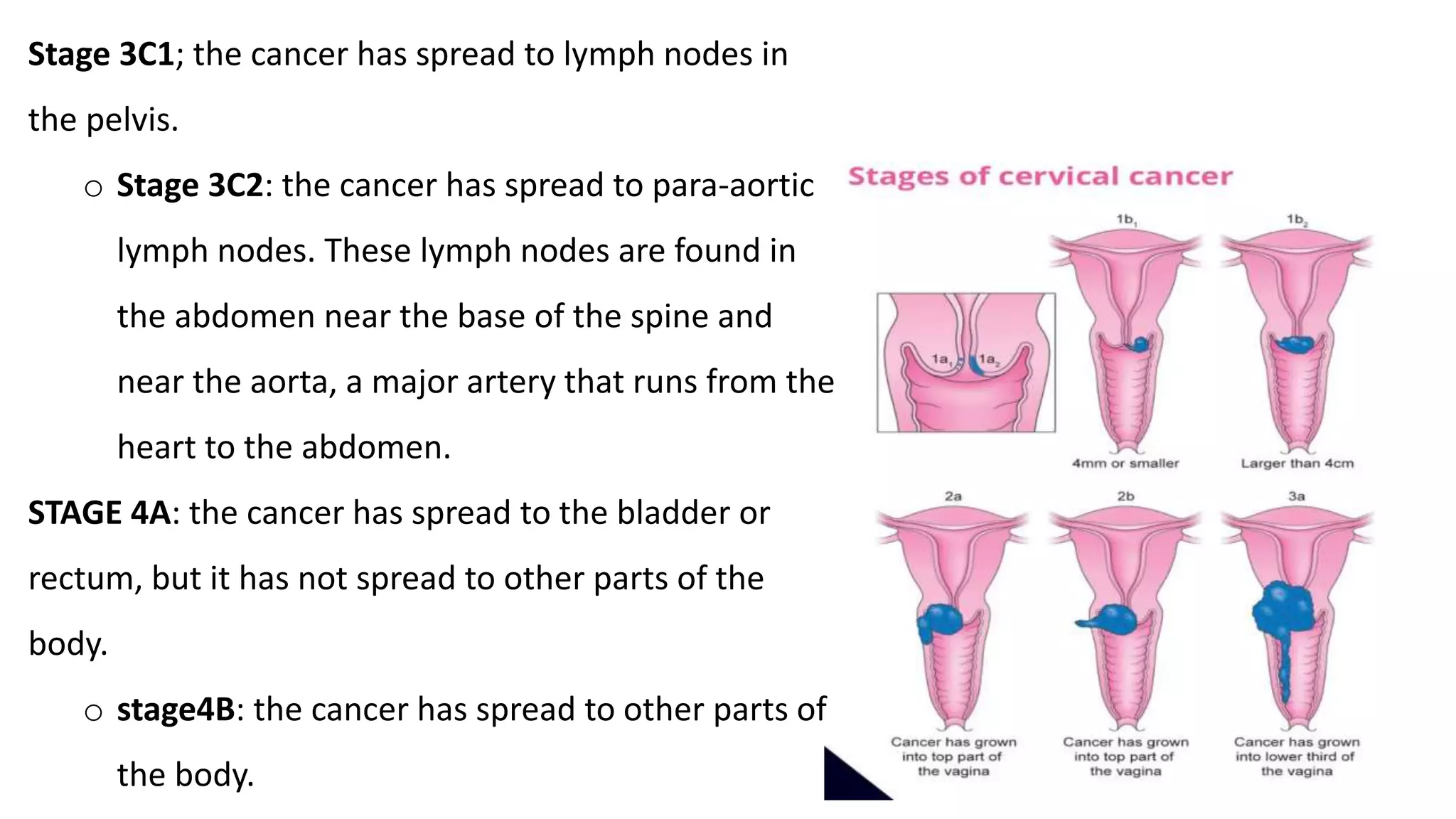cervical cancer.pptx
