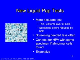 Cervical cancer hpv-feb07 | PPT
