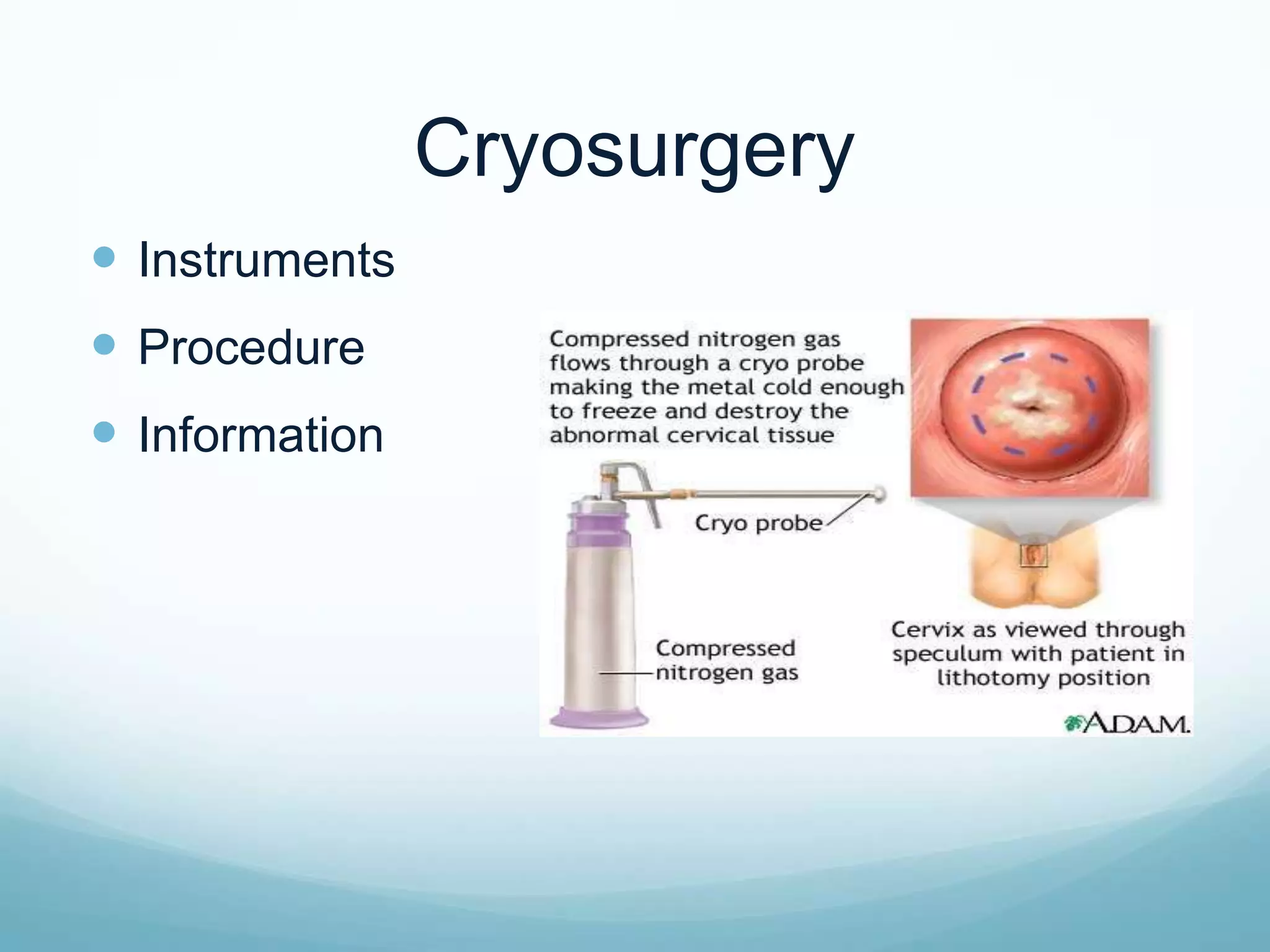 Cervical cancer1 | PPSX