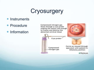 Cervical cancer1 | PPSX