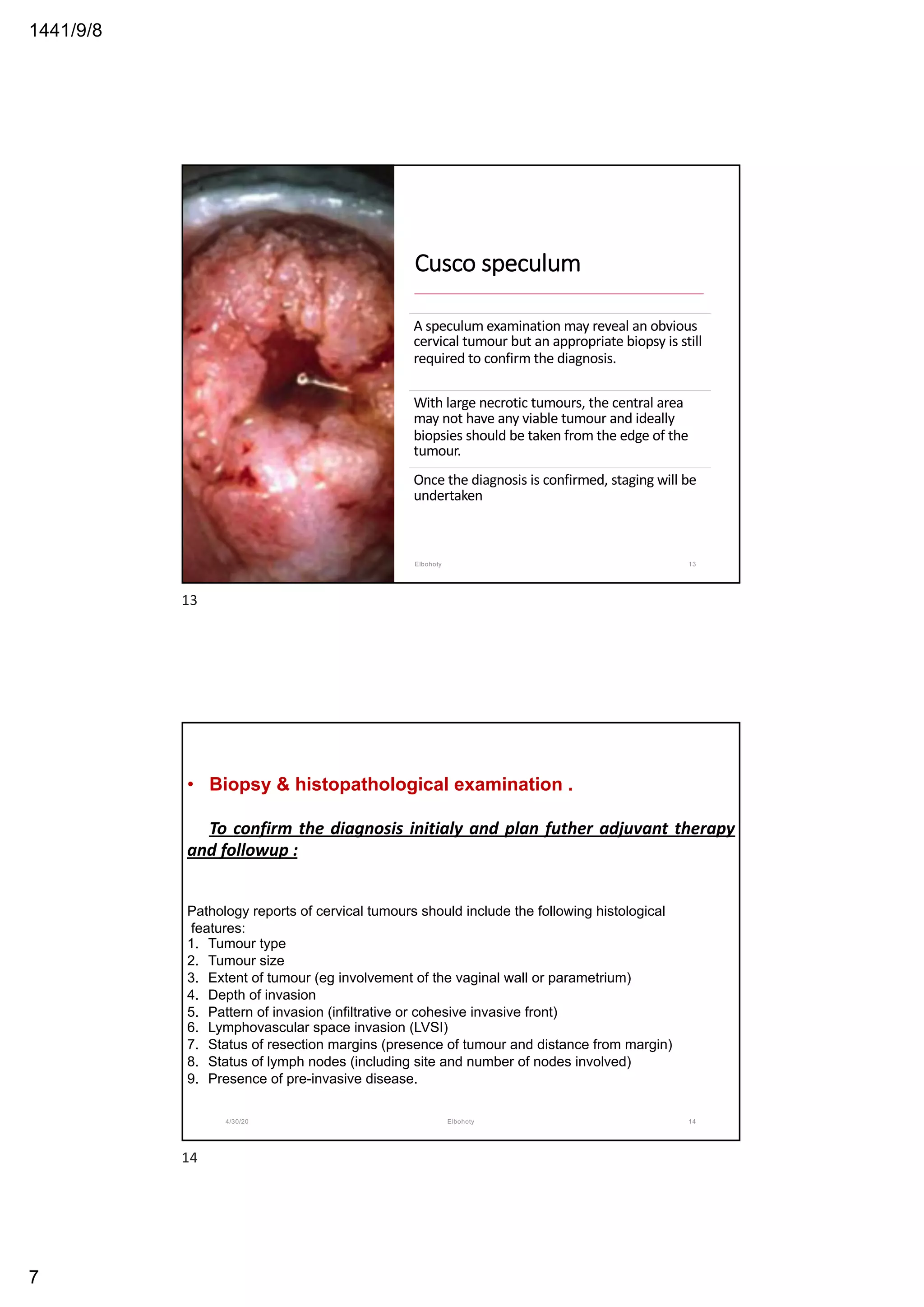 Cervical cancer1 | PDF