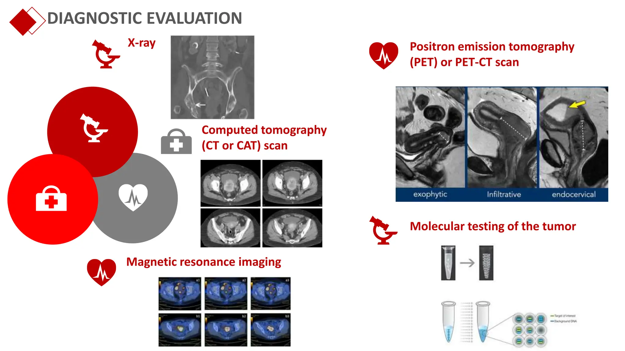 CERVICAL CANCER (1).pptx obstetrics and gynaecology research topic | PPT