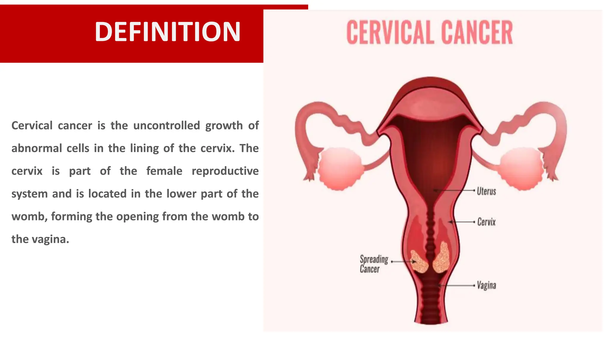 CERVICAL CANCER (1).pptx obstetrics and gynaecology research topic | PPT