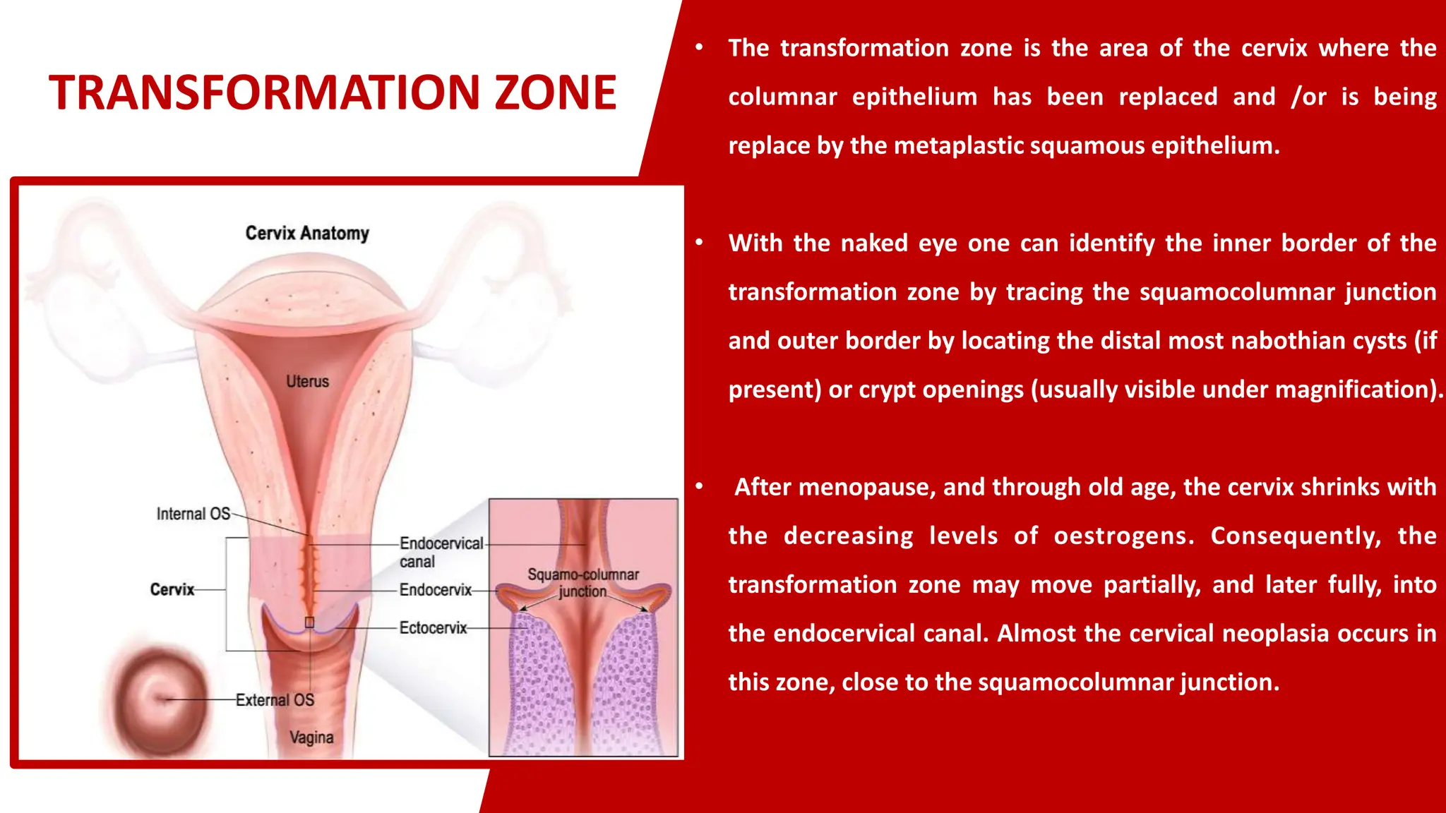CERVICAL CANCER (1).pptx obstetrics and gynaecology research topic | PPT