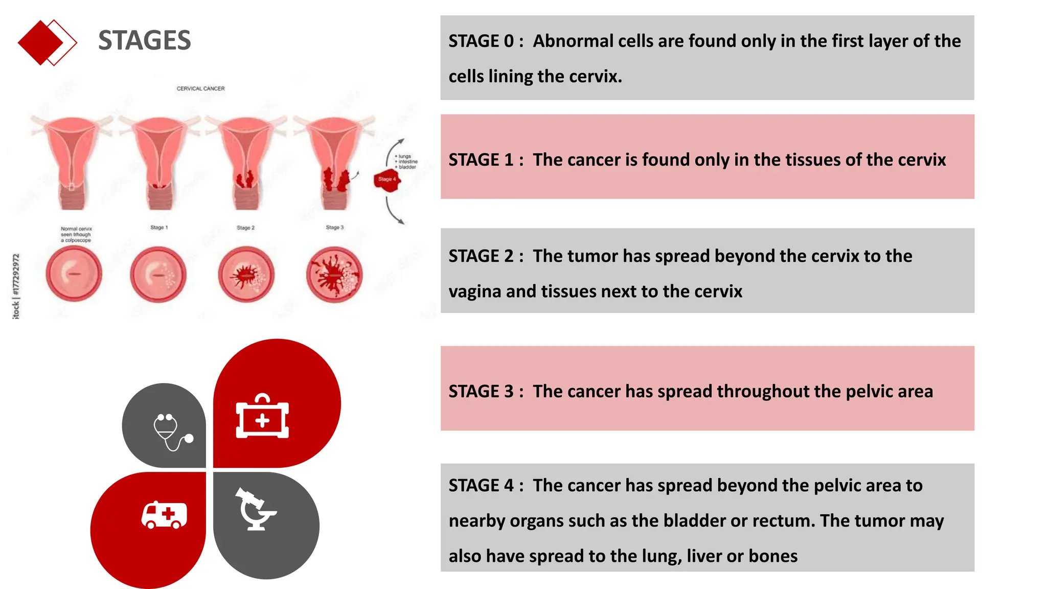 CERVICAL CANCER (1).pptx obstetrics and gynaecology research topic | PPT