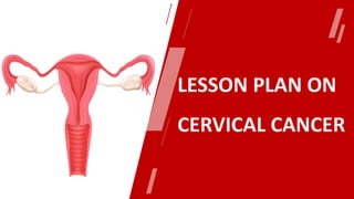 CERVICAL CANCER (1).pptx obstetrics and gynaecology research topic | PPT