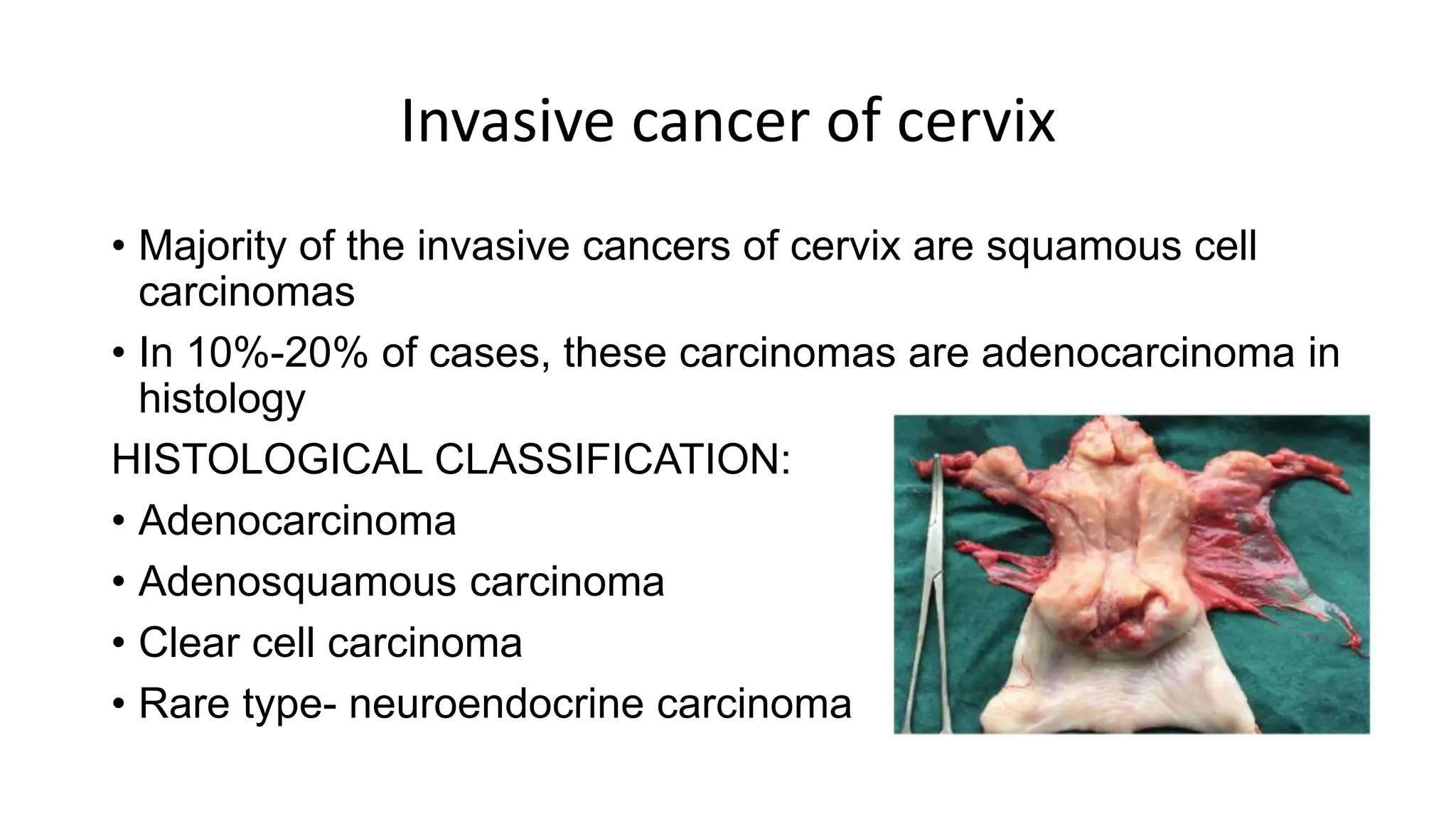 Recent advances on Cervical cancer .pptx