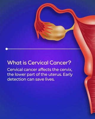 Cervical cancer Awarencess | Naprod Life Sciences | PDF