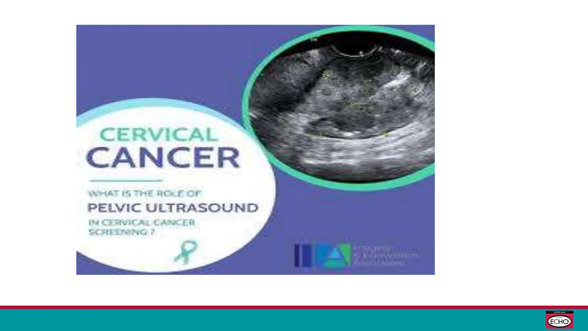 Cervical Cancer_ECHOIndia_PPT_Template (2) (2).pptx