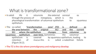 Cervical cancer | PPT
