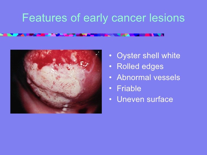 Shoulder to Shoulder: Cervical Cancer Screening