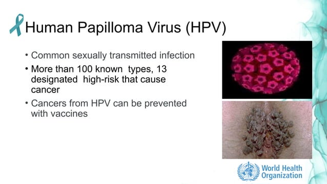 Cervical Cancer Lecture (Definition and Screening Guidelines) | PPTX