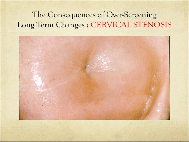 Cervical cancer screening module 1