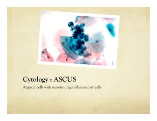 Cervical cancer screening module 2 | PDF