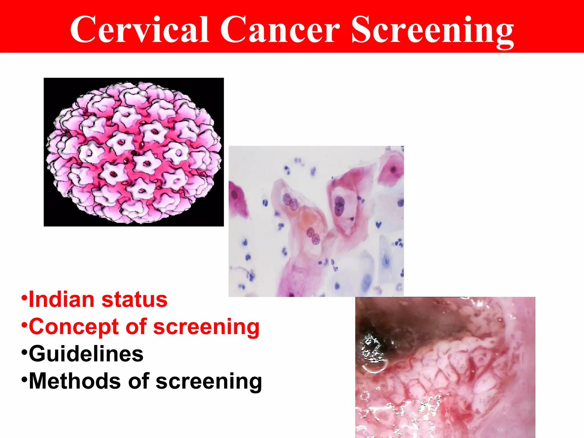 Cervical cancer screening guidelines 2013 | PPT
