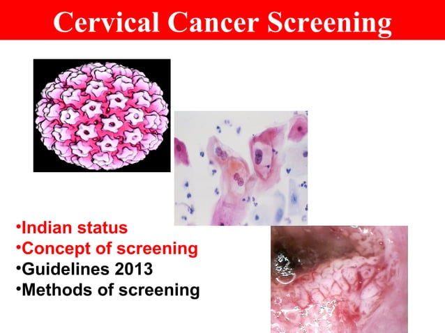 Cervical cancer screening guidelines 2013 on 7th sept | PPT
