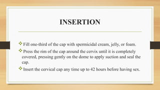 Cervical Caps as method of family planning | PPTX