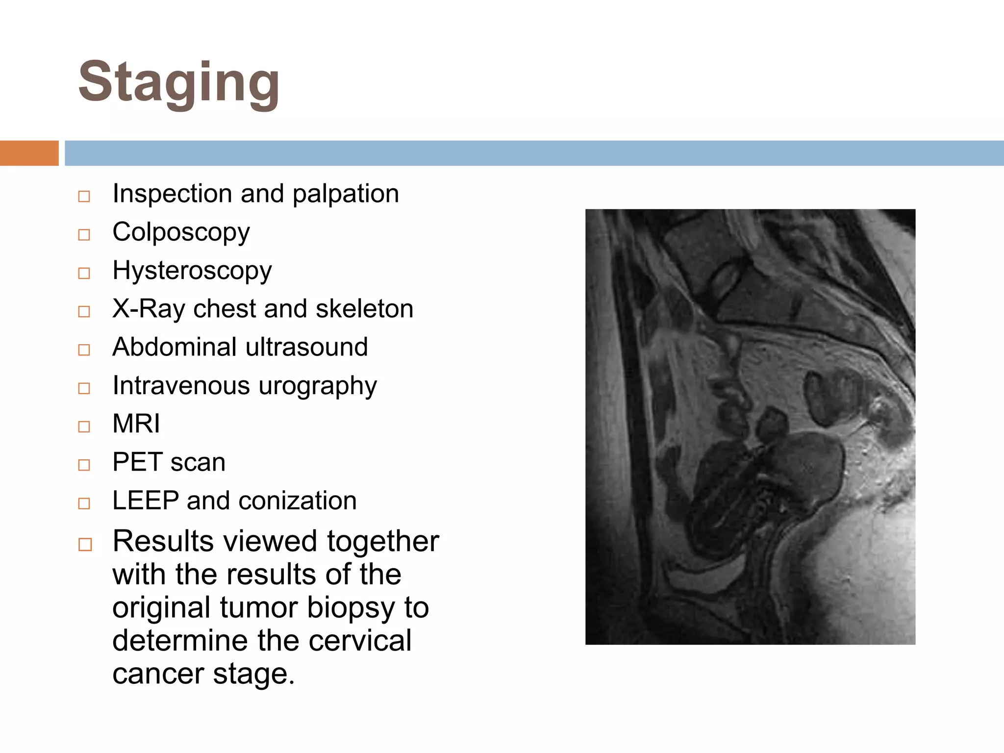 Cervical carcinoma | PPTX