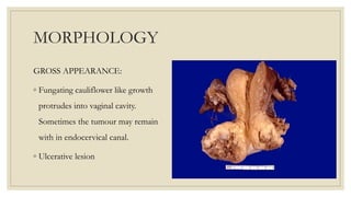 FEMALE GENITAL TRACT AND TUMORS .pdf