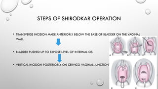 CERVICAL ENCERCLAGE IN PREGNANCY .pptx