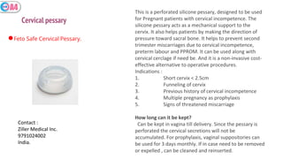 Cervical cerclage procedure | PPTX
