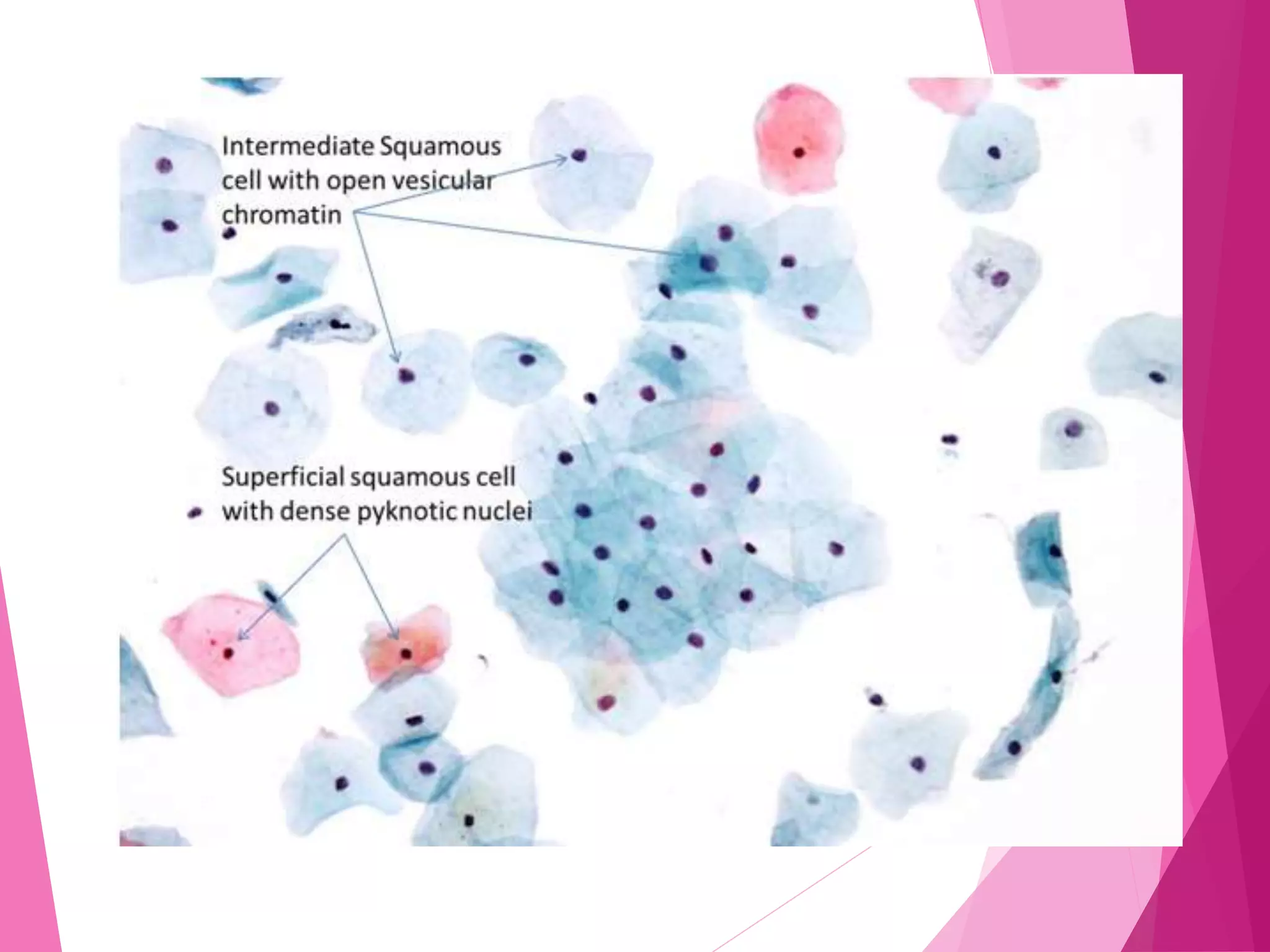 Cervical cytology | PPTX