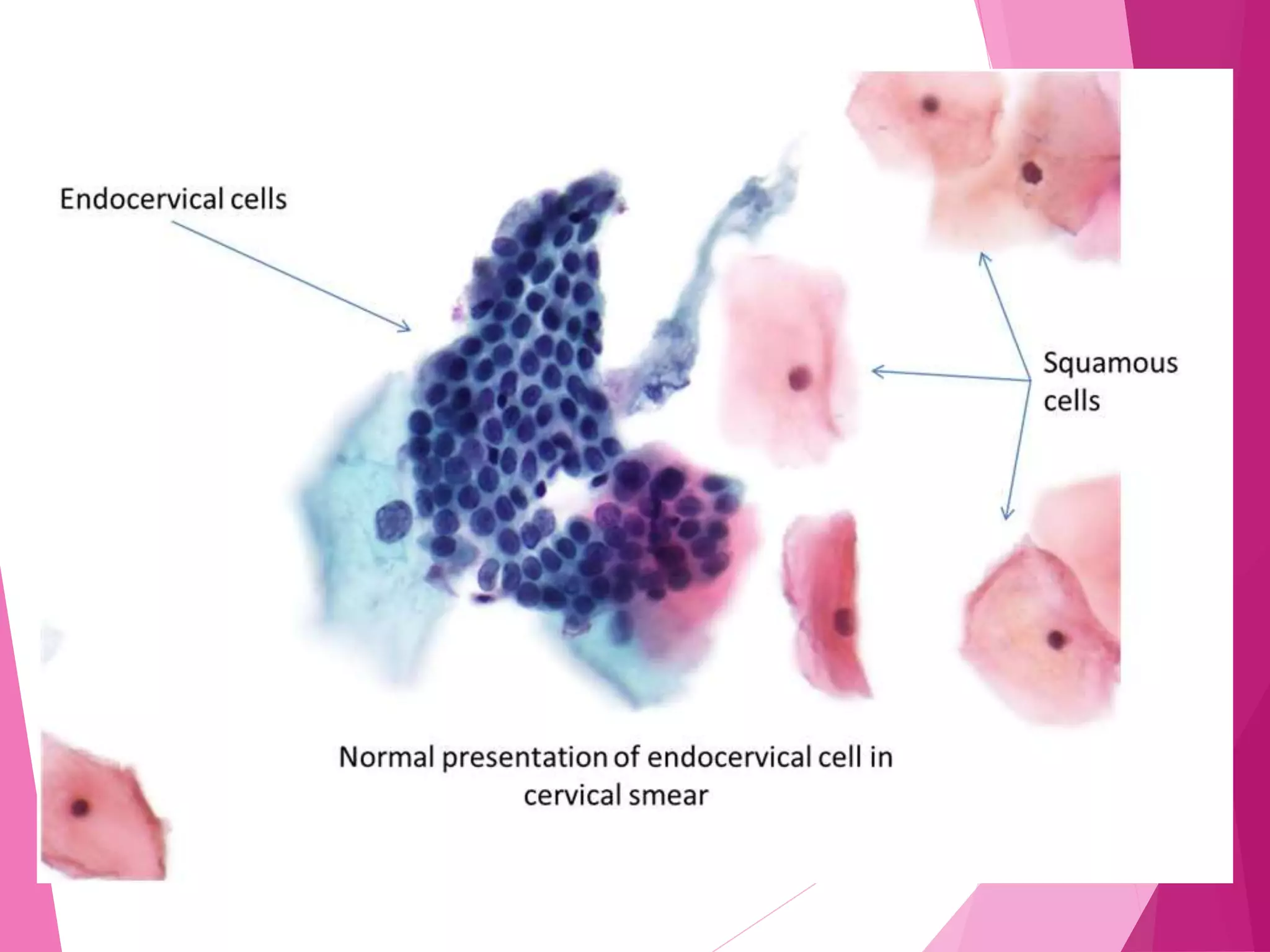 Cervical cytology | PPTX