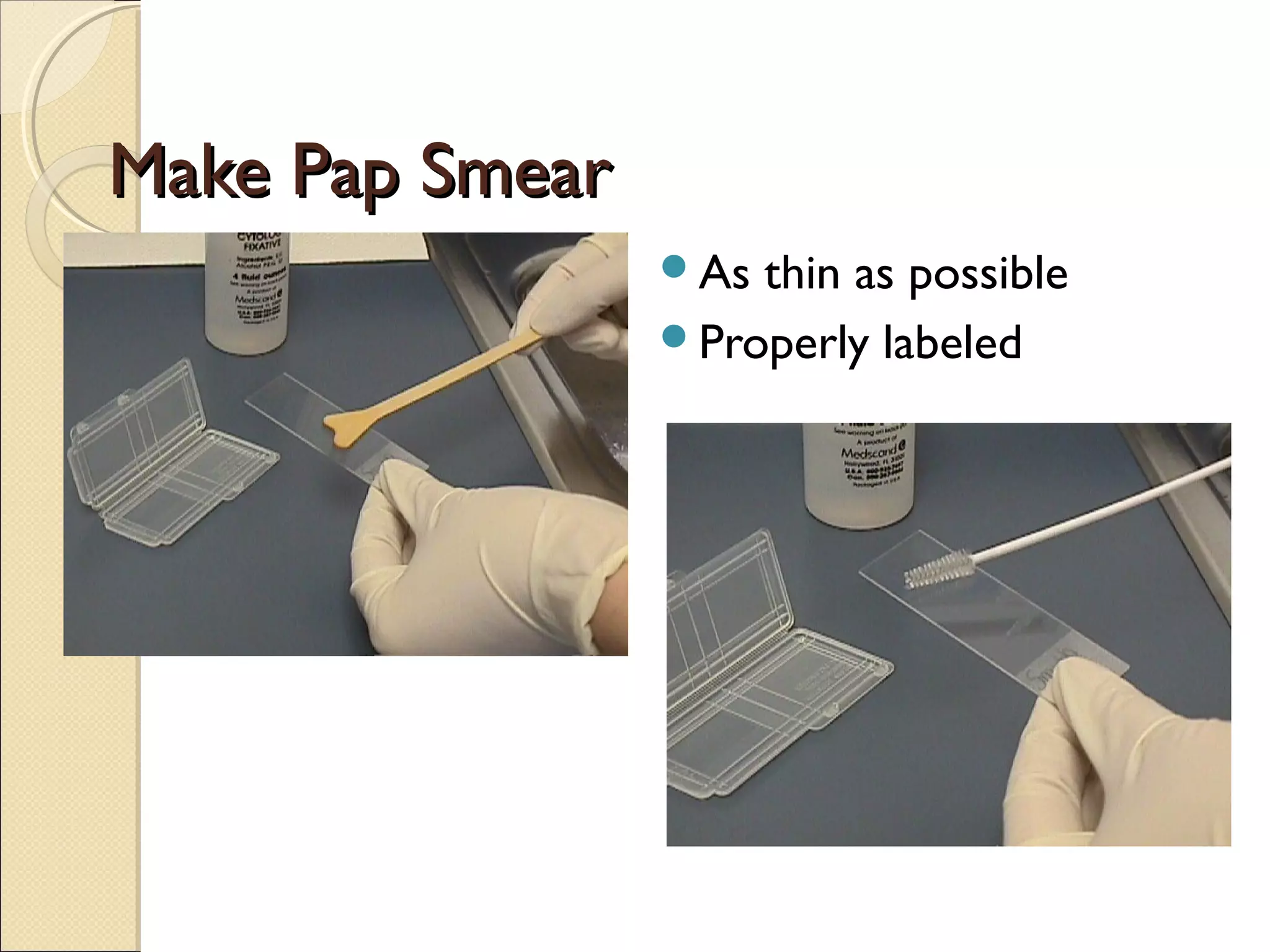 Cervical cytopathology | PPT