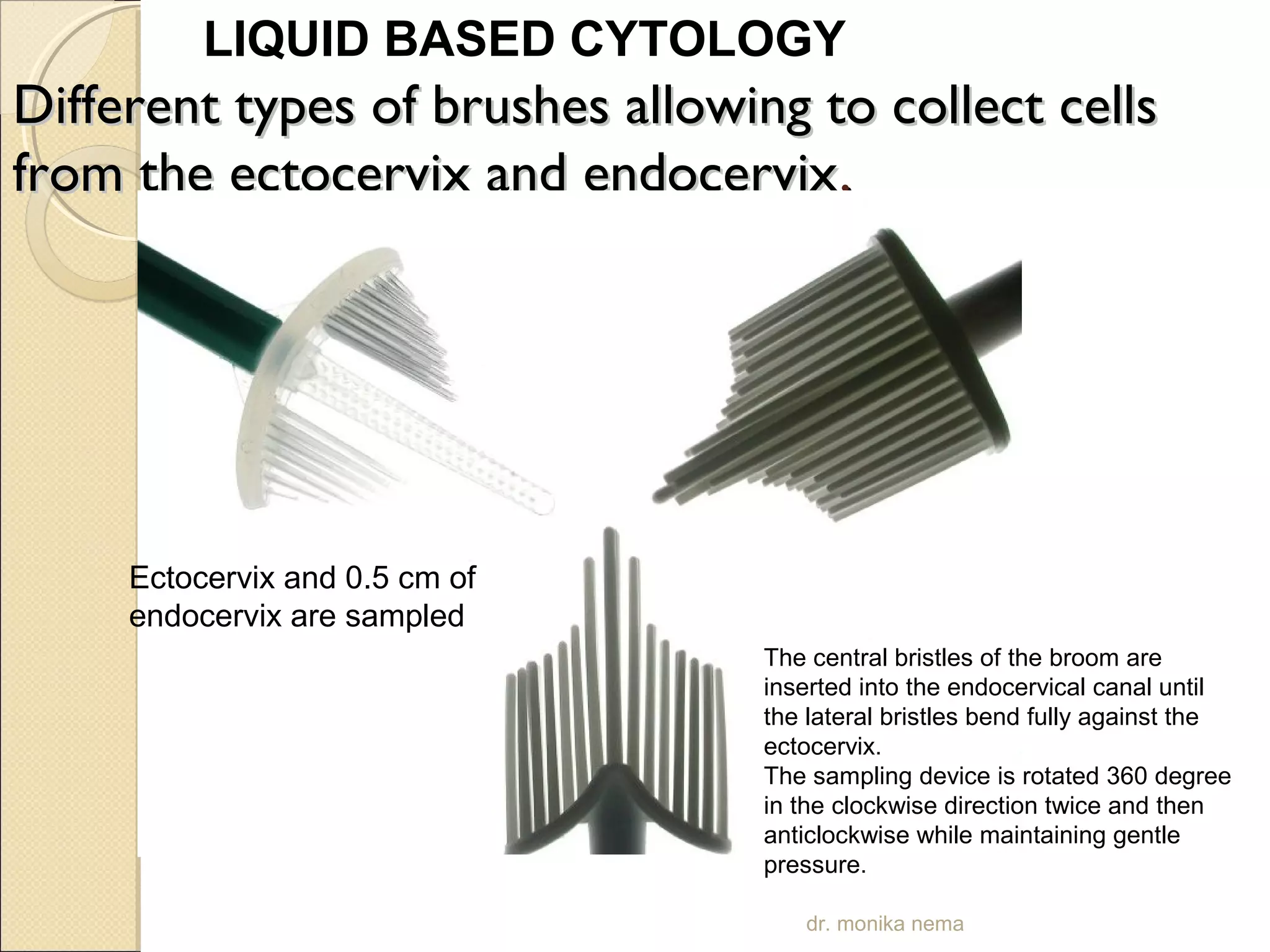 Cervical cytopathology | PPT