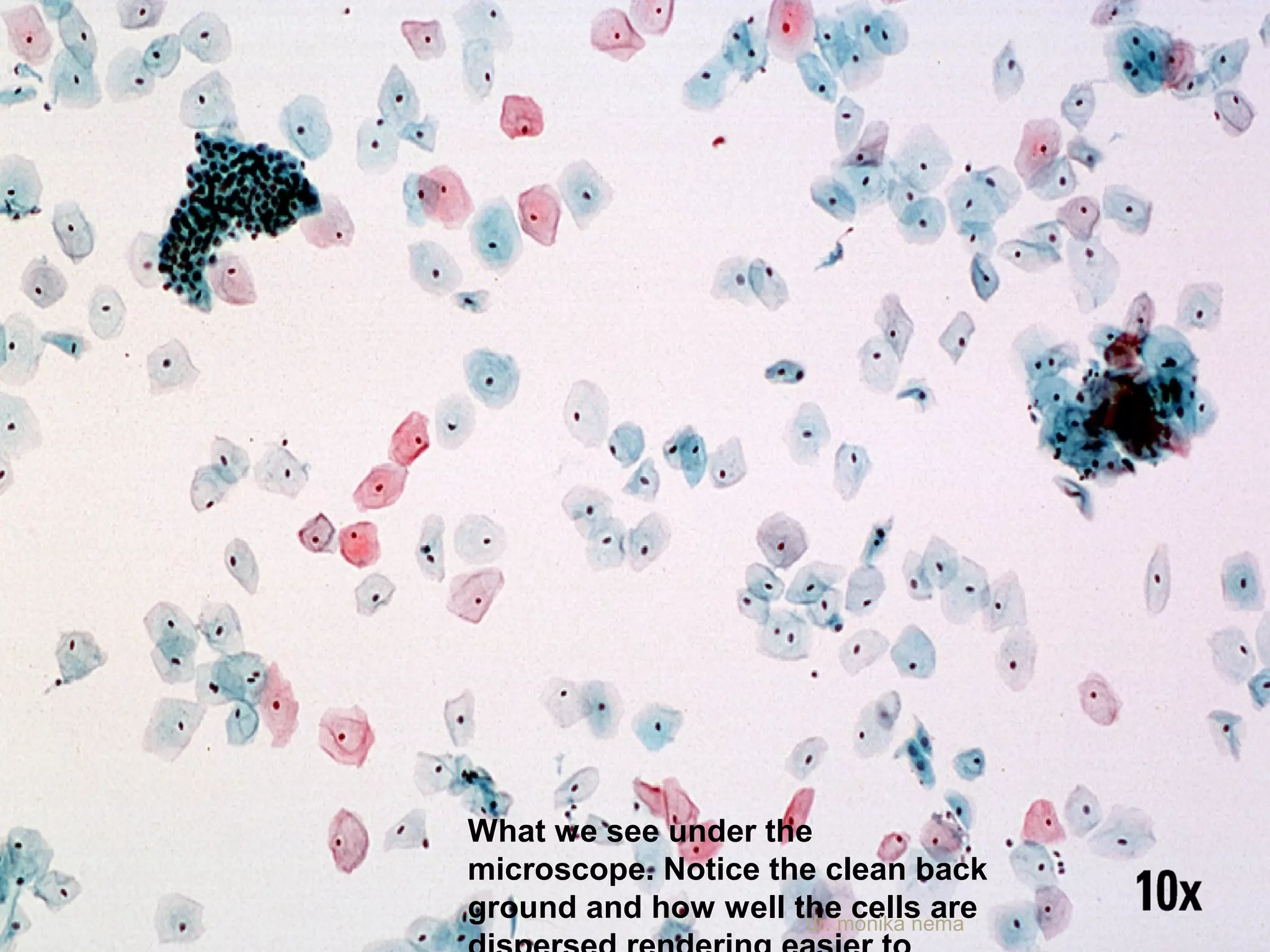 Cervical cytopathology | PPT
