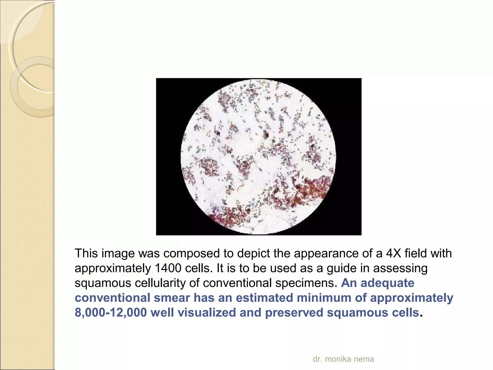 Cervical cytopathology | PPT