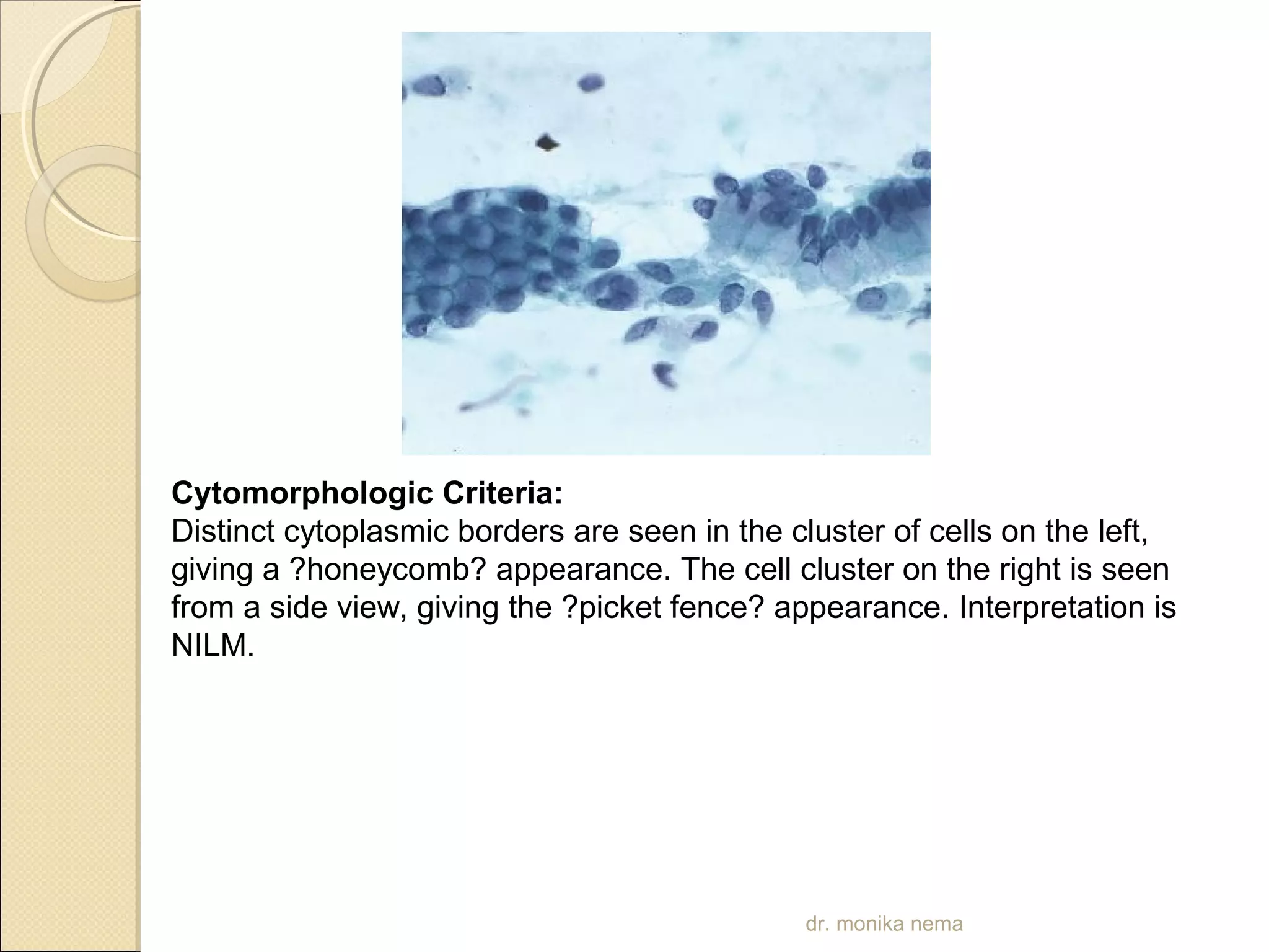 Cervical cytopathology | PPT
