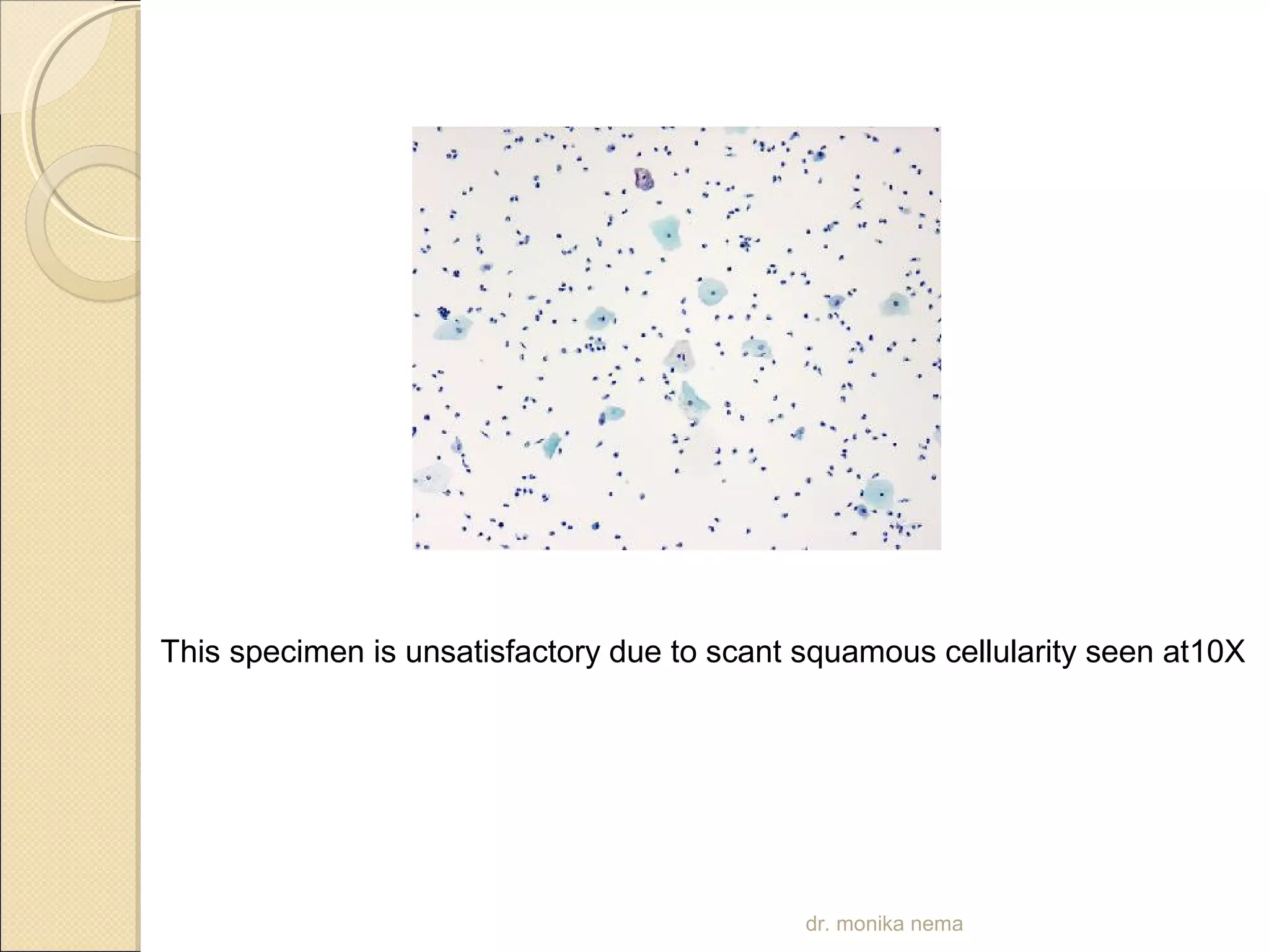 Cervical cytopathology | PPT