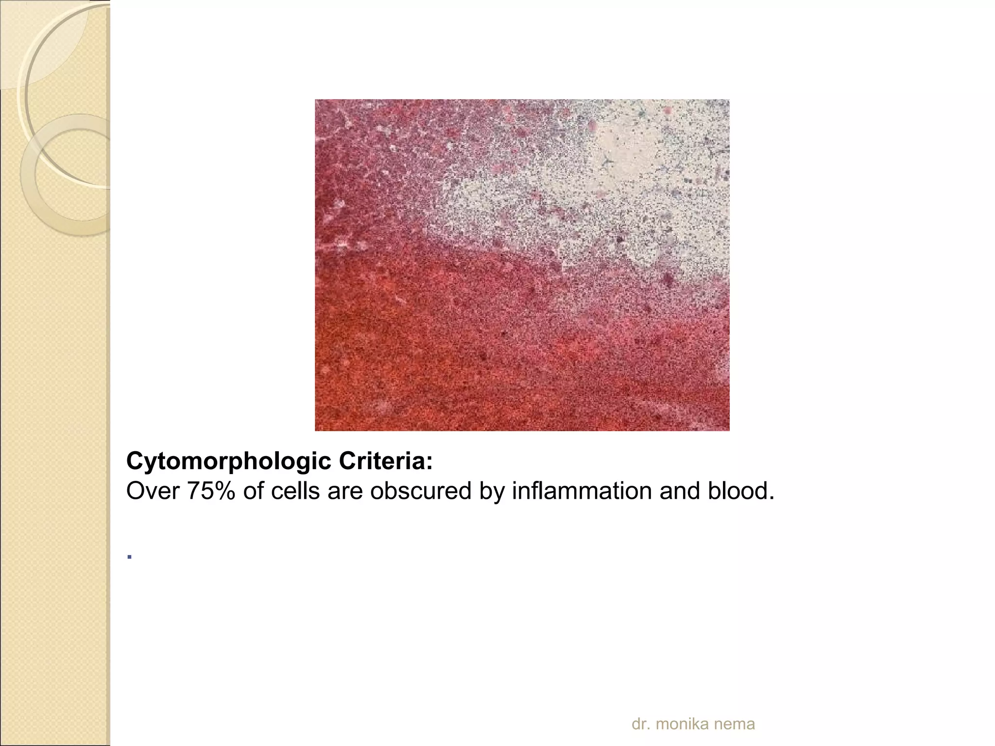 Cervical cytopathology | PPT