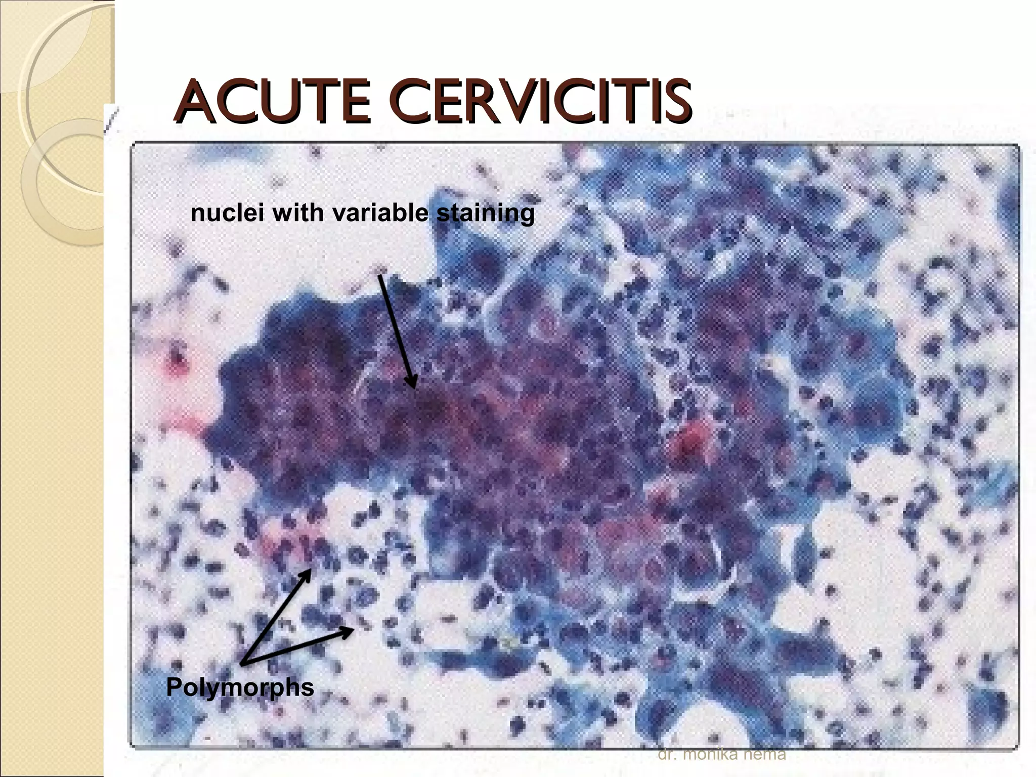 Cervical cytopathology | PPT