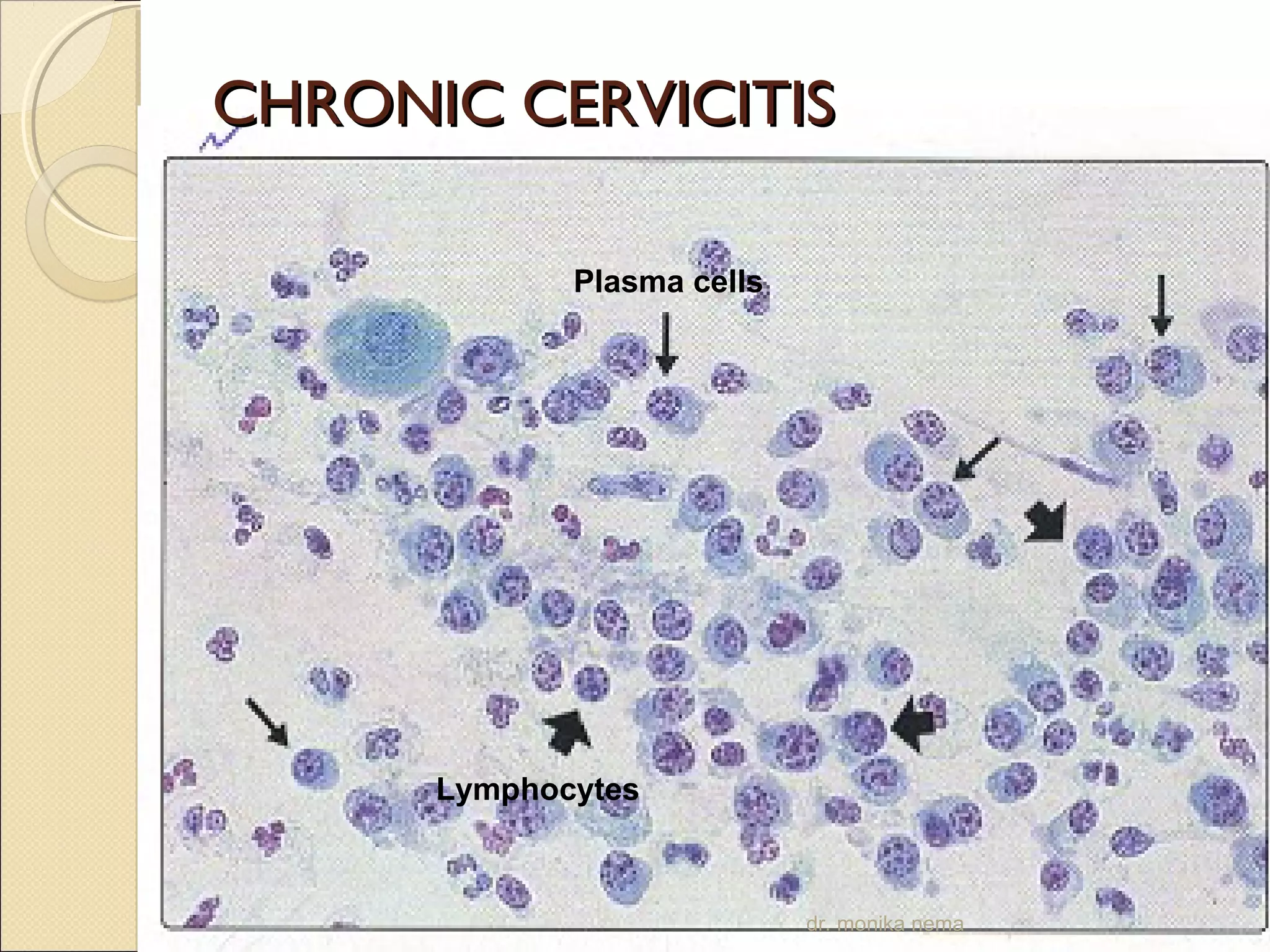 Cervical cytopathology | PPT