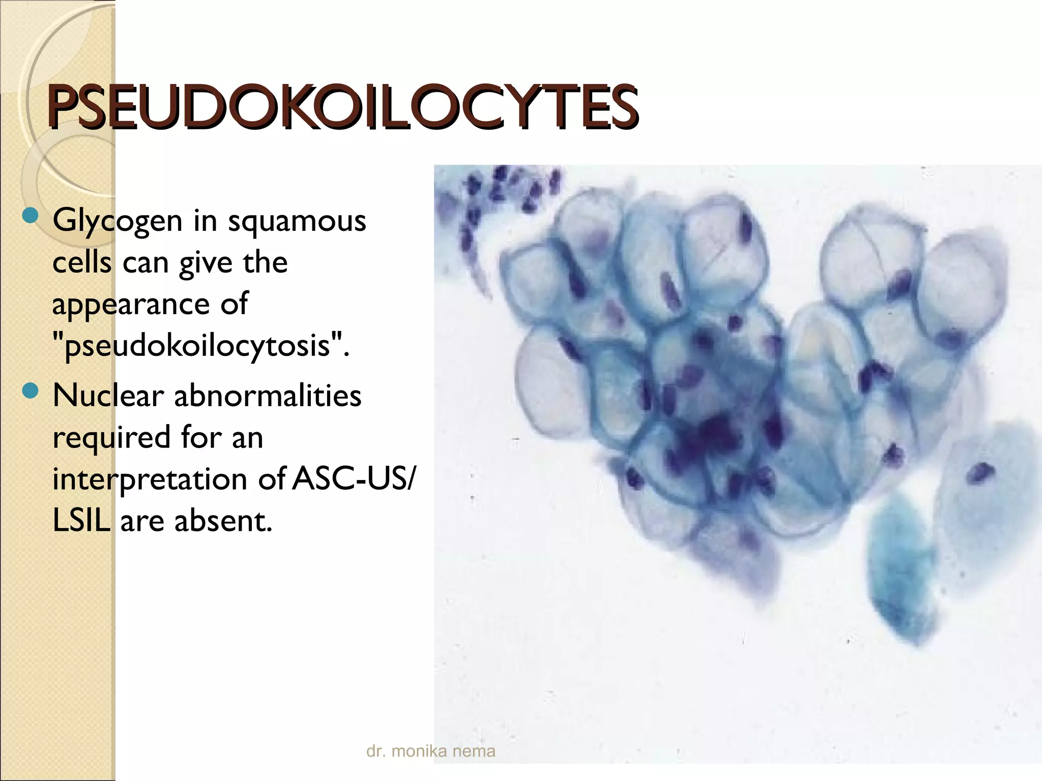 Cervical cytopathology | PPT