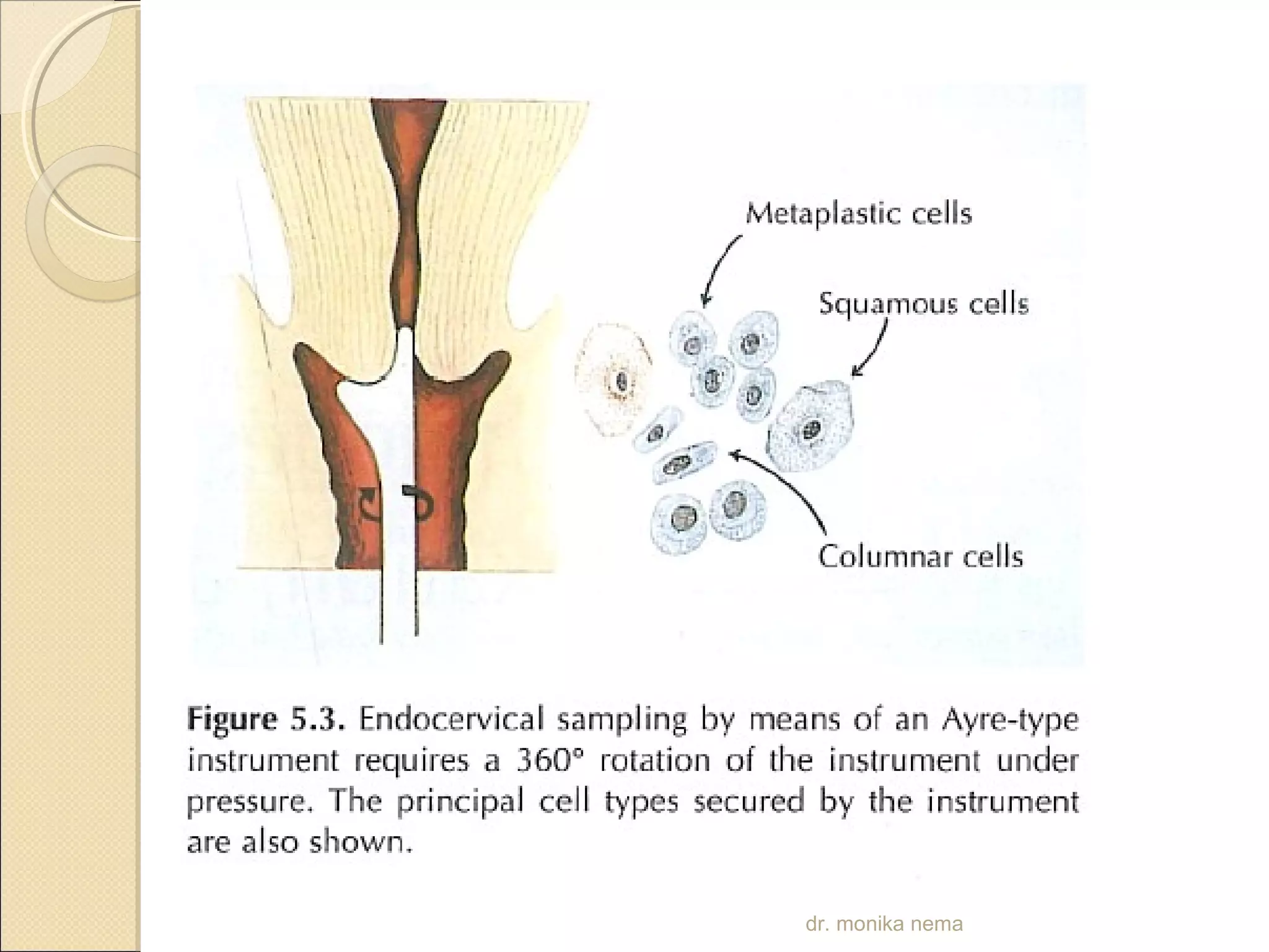 Cervical cytopathology | PPT