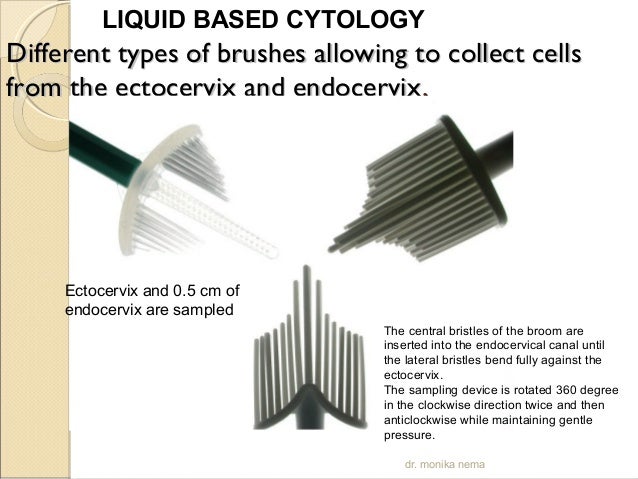 Cervical cytopathology