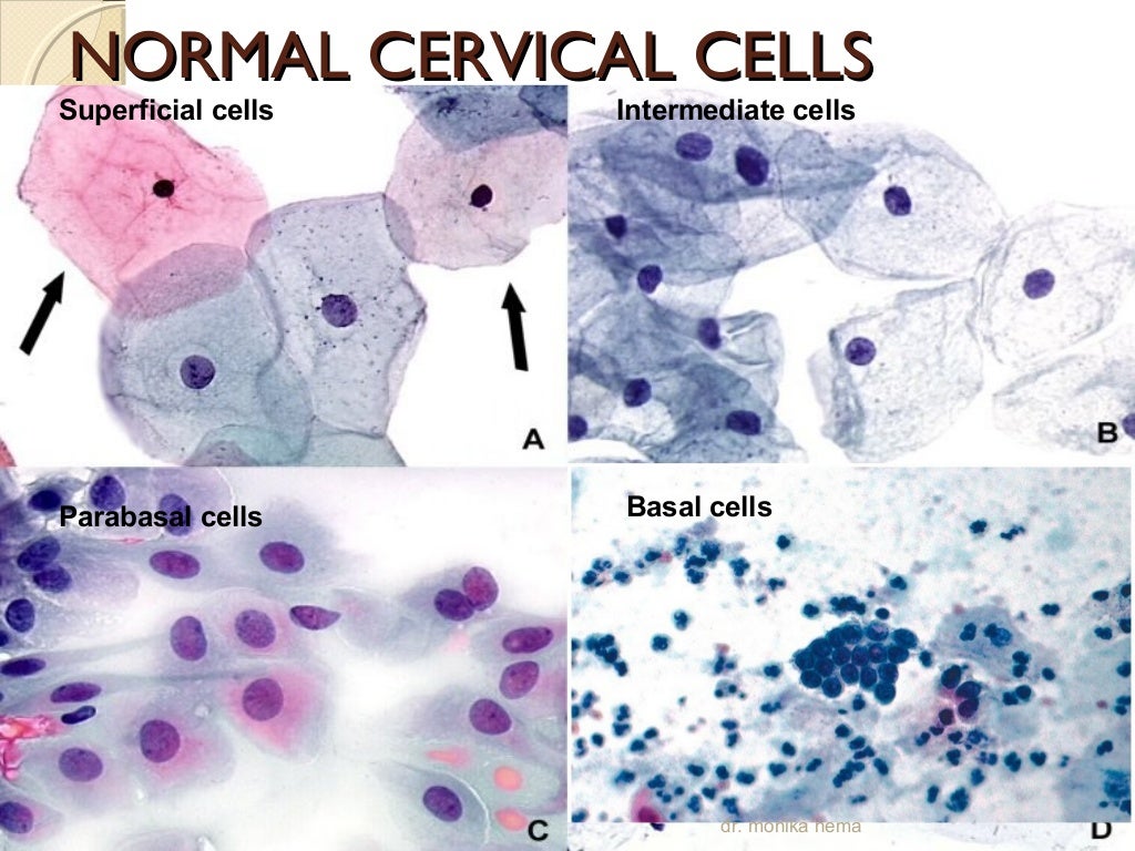 Cervical cytopathology