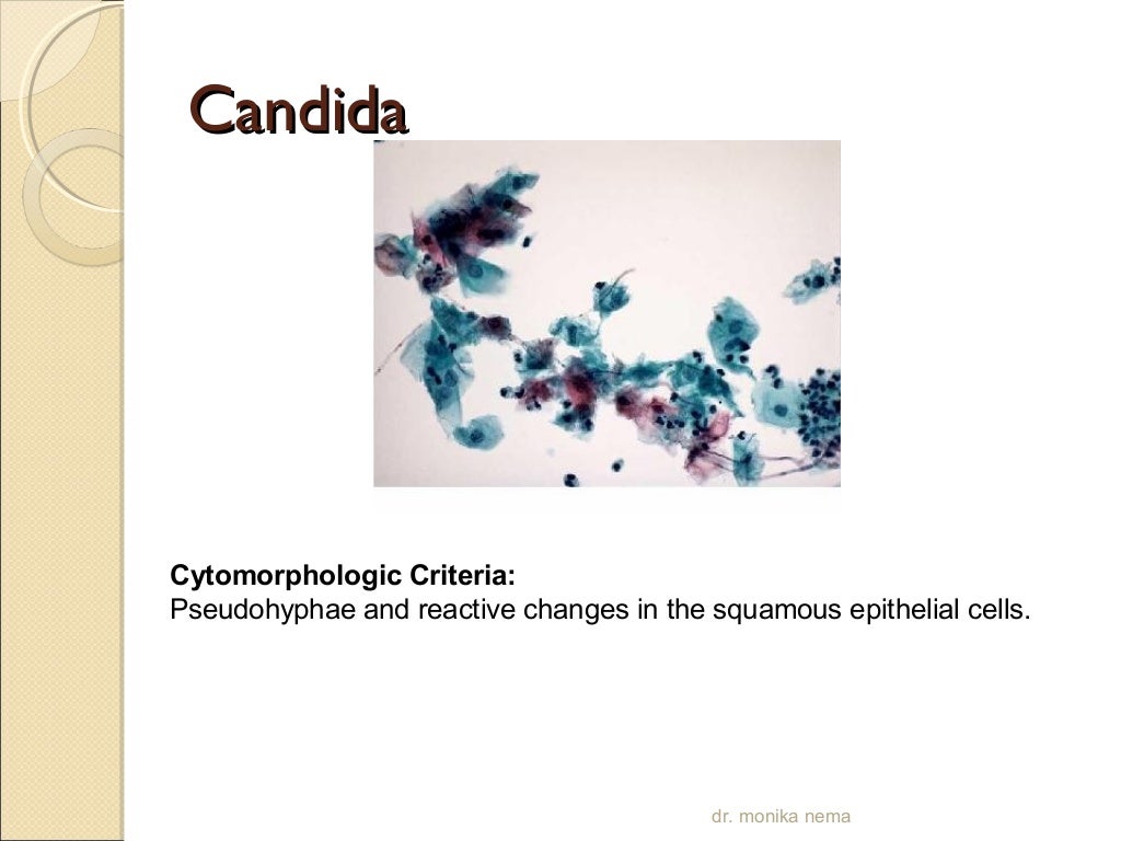 Cervical cytopathology