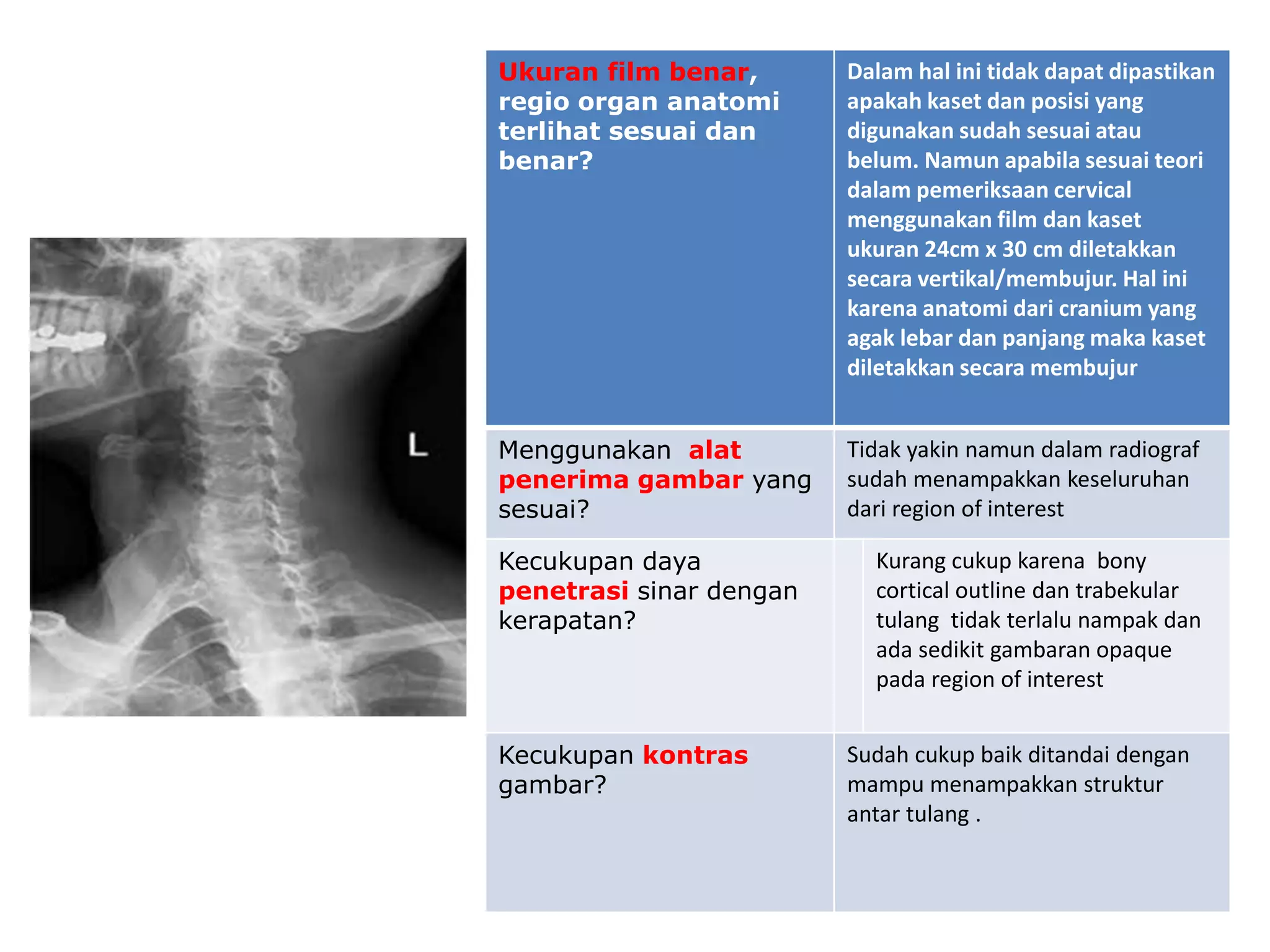 ppt kritisi dan evaluasi radiograf Cervical dan thoracal | PPTX