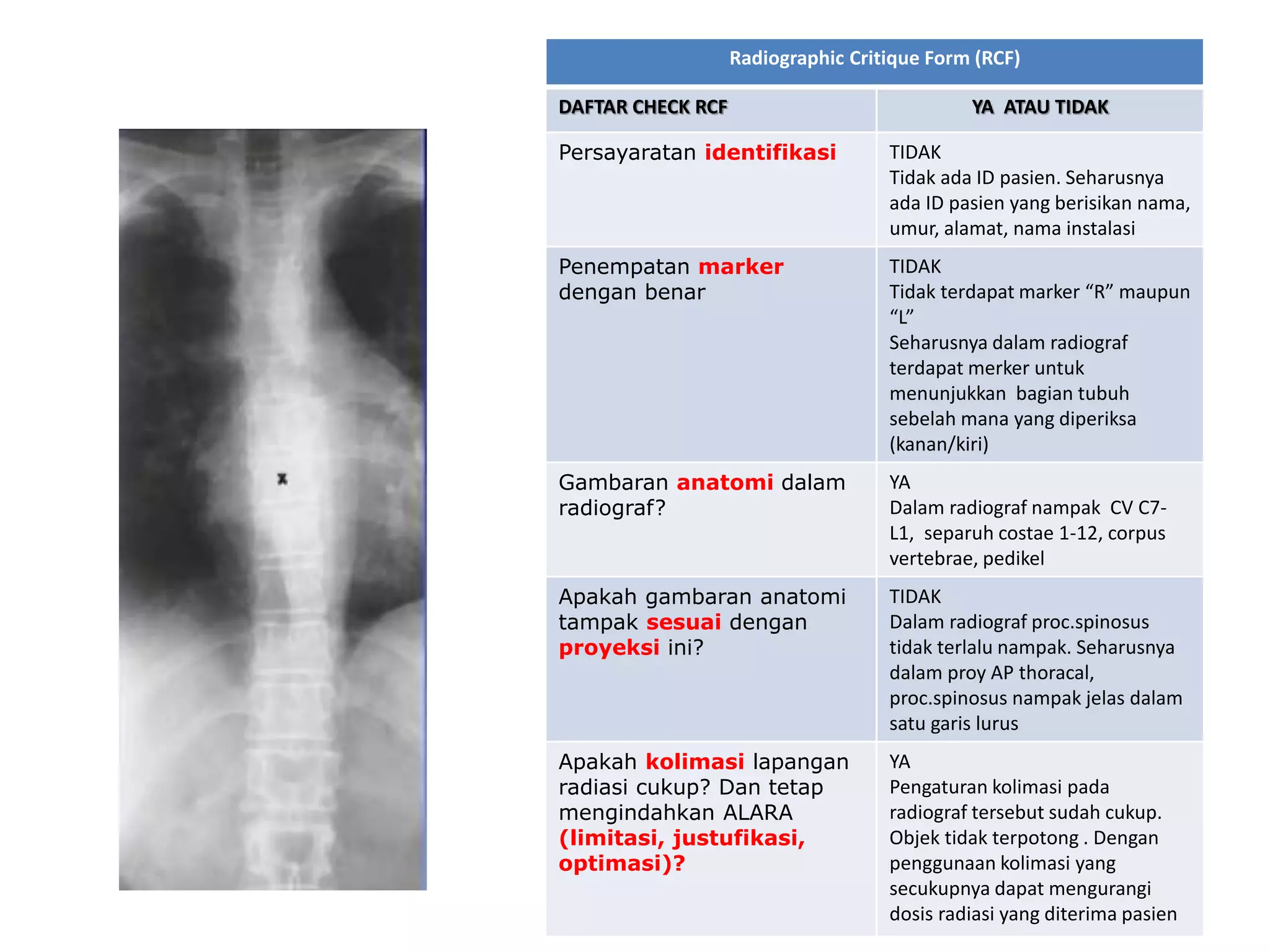 ppt kritisi dan evaluasi radiograf Cervical dan thoracal | PPTX